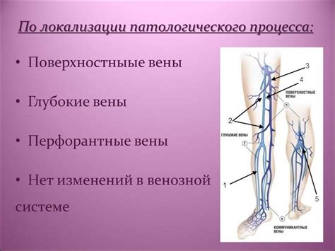 Варикозная болезнь нижних конечностей презентация онлайн