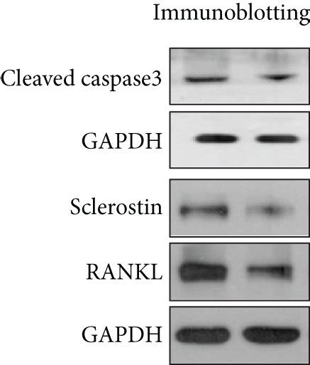 Foxo1 Plays As A Key Regulator Of Age Induced Mlo Y4 Cell Apoptosis And