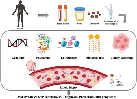 Progress On Diagnostic And Prognostic Markers Of Pancreatic Cancer
