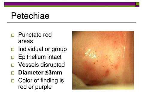 Ppt Clinical Considerations Powerpoint Presentation Id 1569779