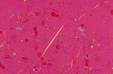 Cppd Crystals