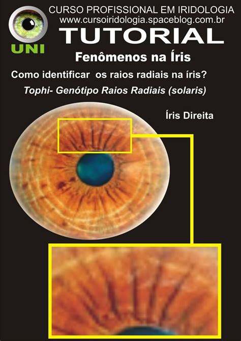 Tutoriais Do Curso De Iridologia Tutoriais Naturopatia Iris Olho