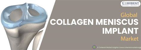 Top Companies Collagen Meniscus Implant Industry