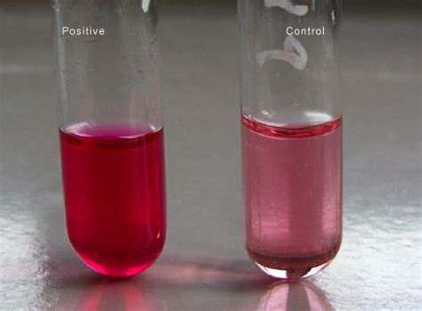 Inulin Fermentation Test For Penumococci Differentiation Medical Laboratories