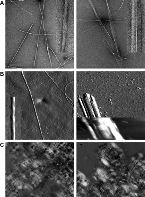 Morphological Differences Between Amyloid Formed By The Adrs Isomers Download Scientific