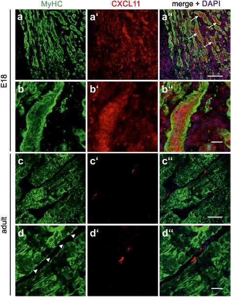 Localization Of Cxcl11 Expression In Developing And Adult Limb Muscles