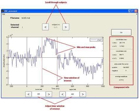 ERP ANALYSIS