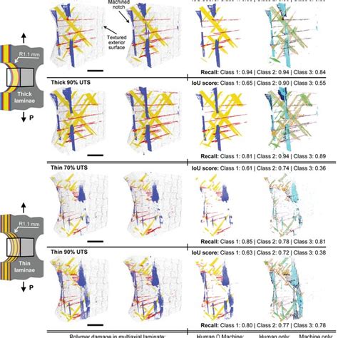 Comparison Of 3d Segmentations Of Selected Test Set Scans Thick And