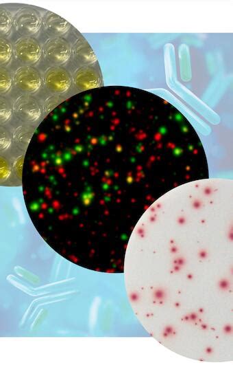 U Cytech Biosciences On Linkedin T Cell Elispot Elisa Fluorospot And B Cell Elispot Kits U