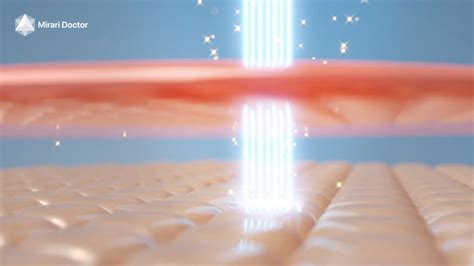 Cold Plasma Revolutionary Medical Technology Transforming Healthcare Treatment