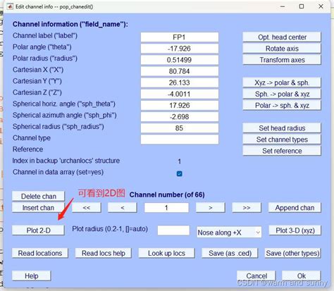 脑电数据预处理 Csdn博客