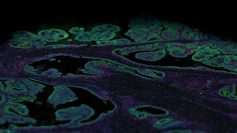 Geomx Digital Spatial Profiler Oncology Grant Program Nanostring