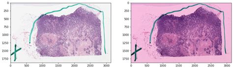 Color Normalization — Histomicstk 010 Documentation