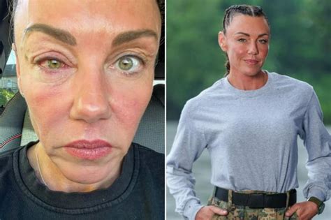 Michelle Heaton Left With Blurred Vision From Celeb Sas As Liberty X Singer Reveals Shocking
