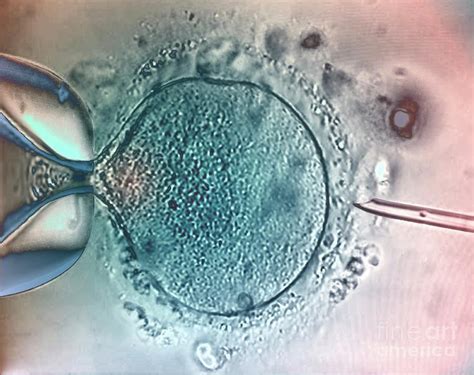 In Vitro Fertilisation Photograph By Zephyrscience Photo Library