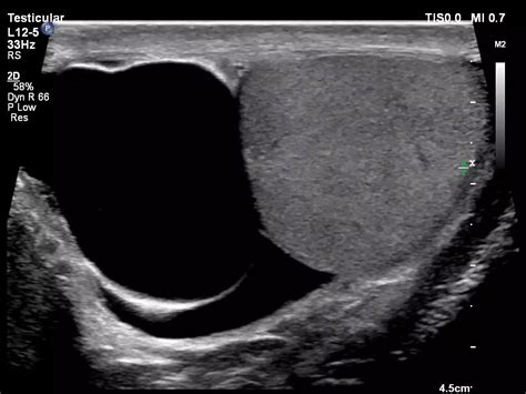 Philips Affiniti 50 Ultrasound System