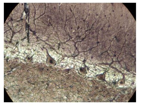 Outer Granular Layer Cerebral Cortex Funicular Layercerebrum Internal