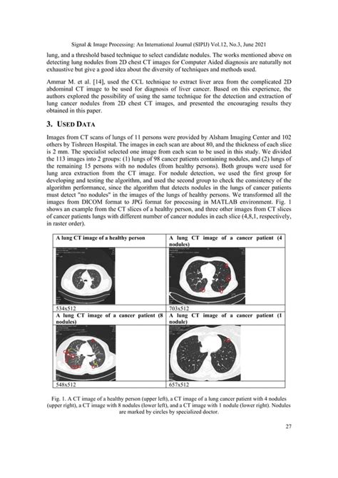 Using Distance Measure Based Classification In Automatic Extraction Of