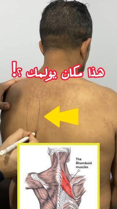 هذا مكان ألم الأبهر In 2024 Health And Fitness Magazine Stomach Workout Fitness Body