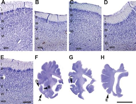 Cytoarchitecture Of The Frontopolar Cortex And The Frontal Convexity In Download Scientific