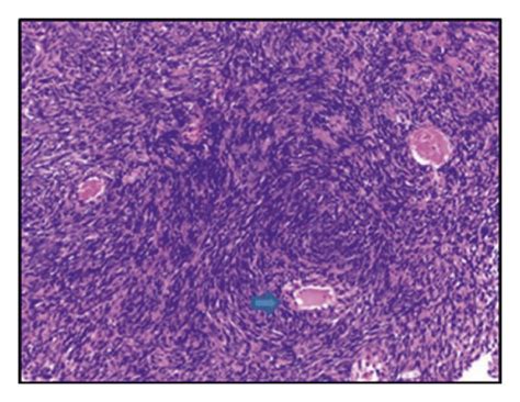 Histopathology Results With 4x Magnification The Green Arrows Show