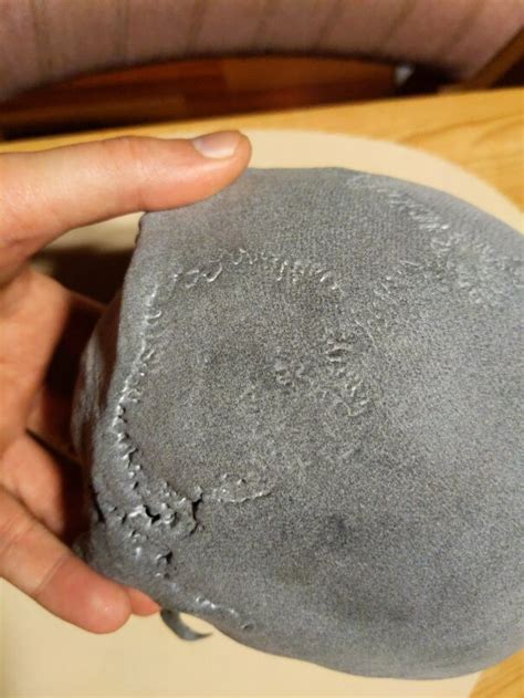 Irregularities In Topology And Density Not Compatible With Half Inca Or