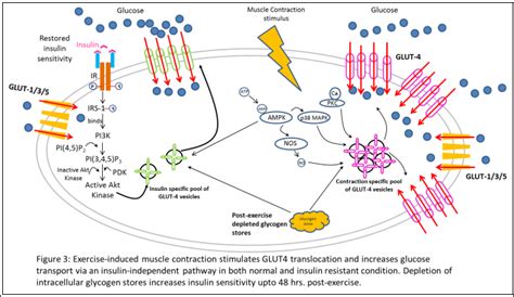 Role Of Exercise In Reducing Insulin Resistance