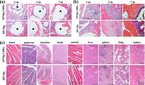 A Histological Analysis Of The Bone Tissues Surrounding The Implants Download Scientific