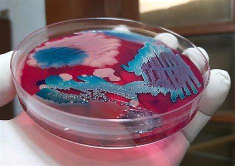 Polystyrene Waste Bacteria May Break Down Polyester Say Brunel