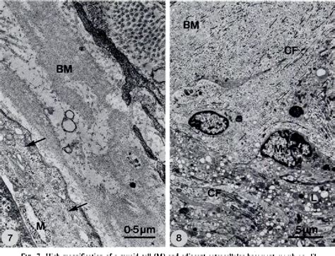Figure 7 From The Peritubular Tissue In The Normal And Pathological
