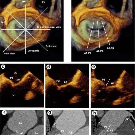 Descending Aorta Short Axis Download Scientific Diagram