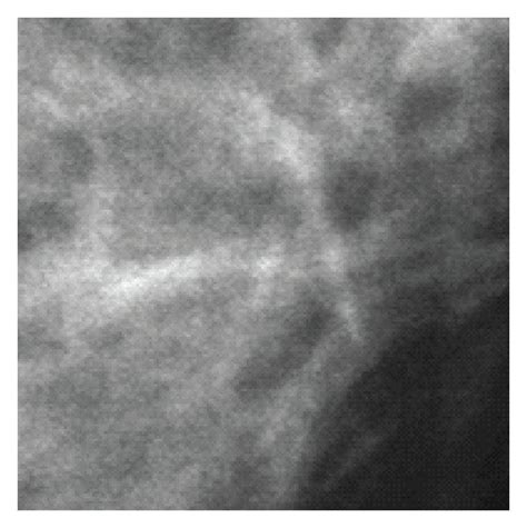 Objects Causing Fps Of Mcs Detection A B Linear Structure Tissues Download Scientific
