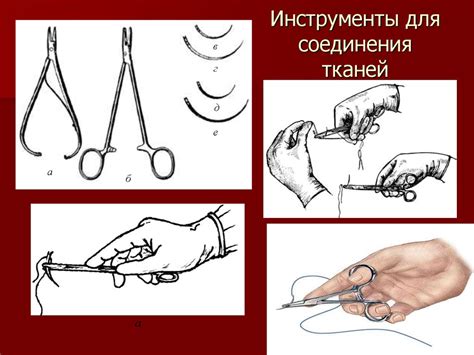 Классификация хирургических инструментов правила пользования Принципы и техника разъединения и