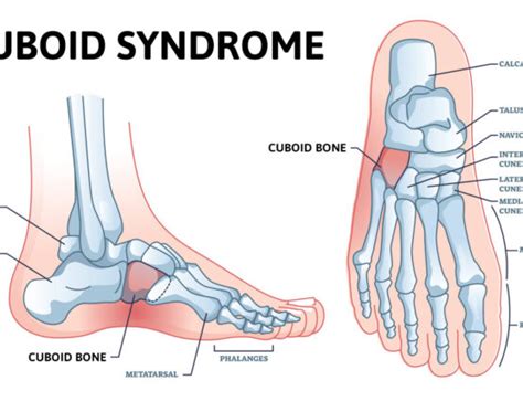 Do Feet Get Bigger As We Age Ask Your Local Podiatrist