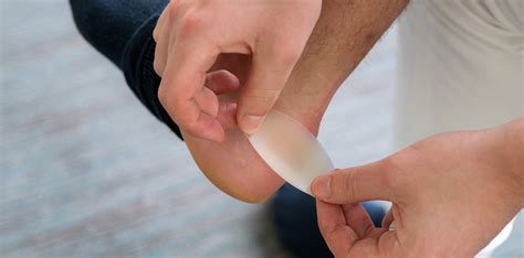 Bloedblaar Alles Over Deze Blaren