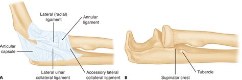 Ortho Globe Lateral Collateral Ligament Reconstruction Of The Elbow
