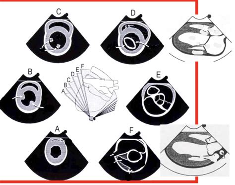 Echocardiogram Views Diagram Quizlet