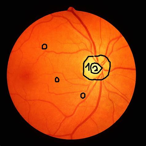 Segment Image By Lines OpenCV