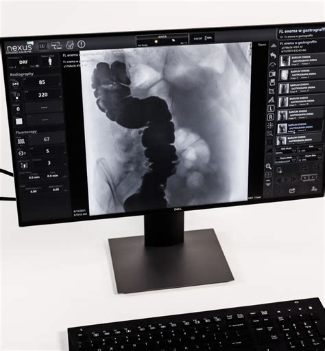 Modality Template Copy Varex Imaging