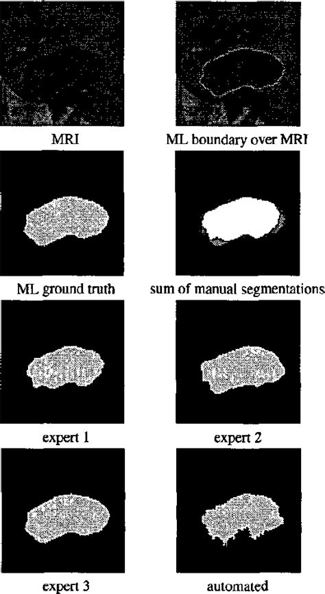 Figure 1 From Simultaneous Validation Of Image Segmentation And