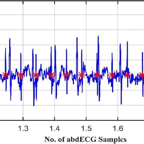 Identified And Marked 21 R Peak Locations Of Fetal Ecg Of Record Download Scientific Diagram