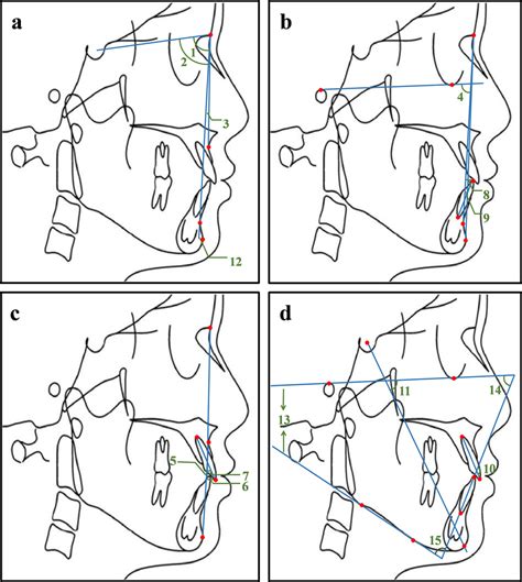 Illustration Of 15 Commonly Used Measurement Items 1 Sna The Angle Download Scientific
