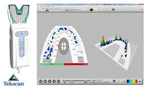 T Scan System The Dental Advisor
