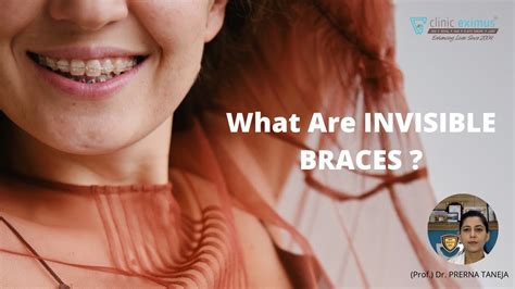 Invisible Braces In Delhi Clinic Eximus