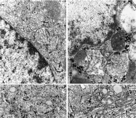 Electron Micrograph Of A Human Hepatocyte In The Liver From A
