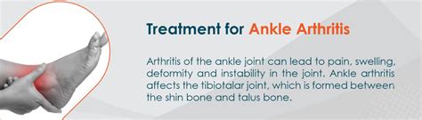 Foot And Ankle Doctor In Delhi Flat Foot Specialist In Delhi Hyprocure