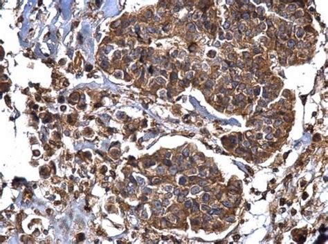 Dynamin 2 Antibody Pa5 29658
