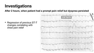 Allergy Induced Myocardial Infarction Kounis Syndrome Coronary Hypersensitivity Disorder