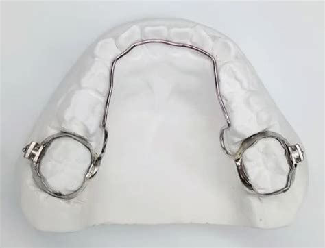 Ortodoncia Soldada Arcodent · Laboratorio De Prótesis Dental En Murcia