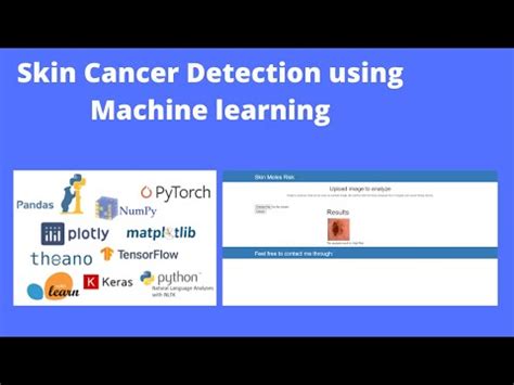 Matlab Code For Skin Cancer Detection Project Projectworlds